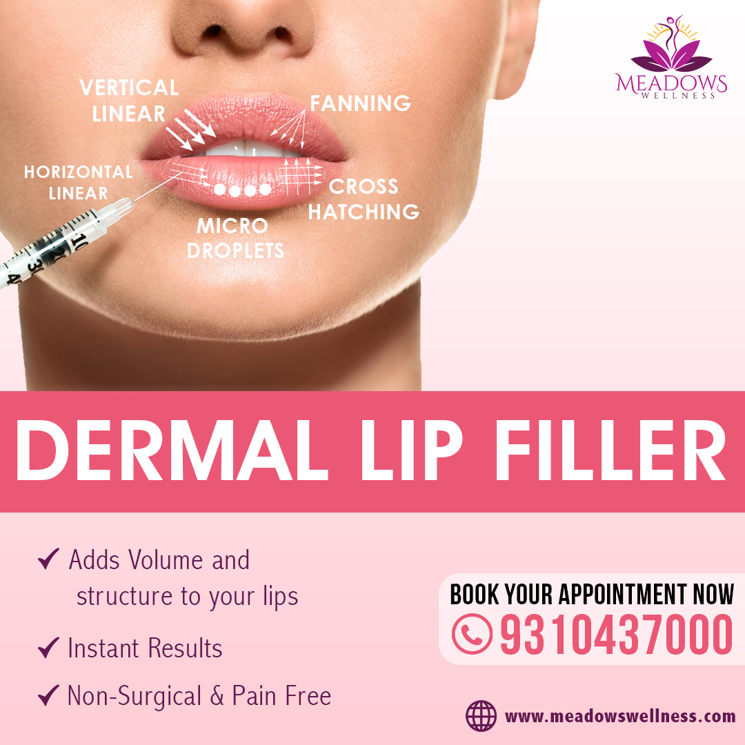 Dermal Fillers: The Key to Youthful Skin - Meadows Wellness - Awarded ...